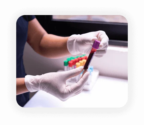 Pathology lab and Diagnostic Centre | Blood test at Home – Rexa Labs